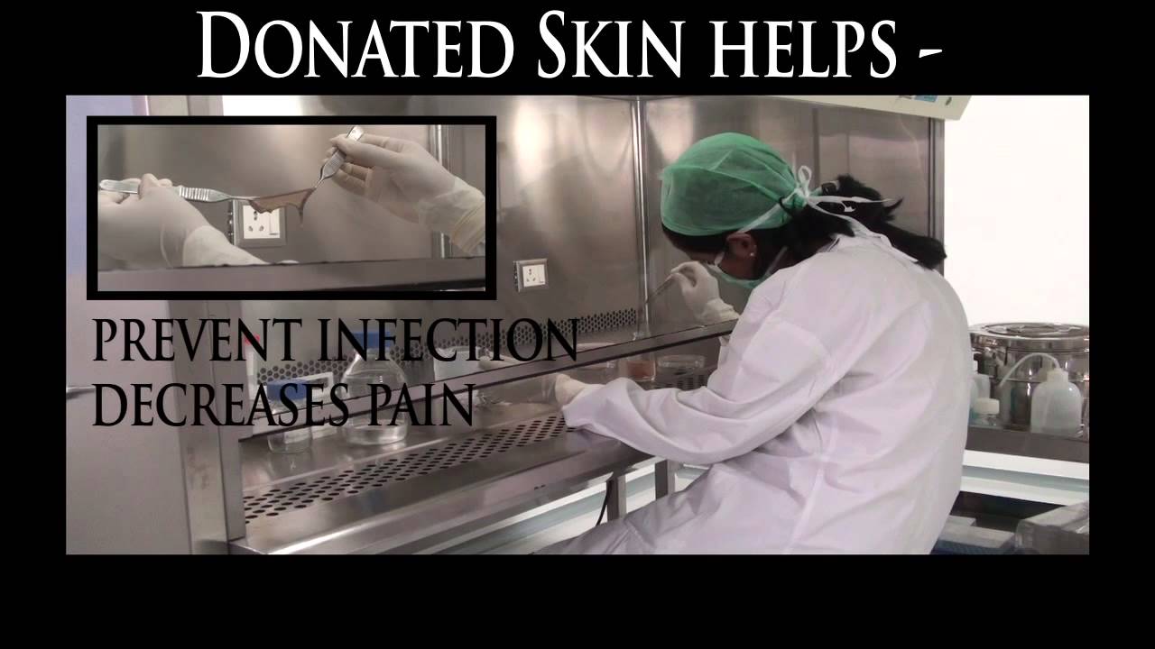 Skin Donation Awareness - Organ India